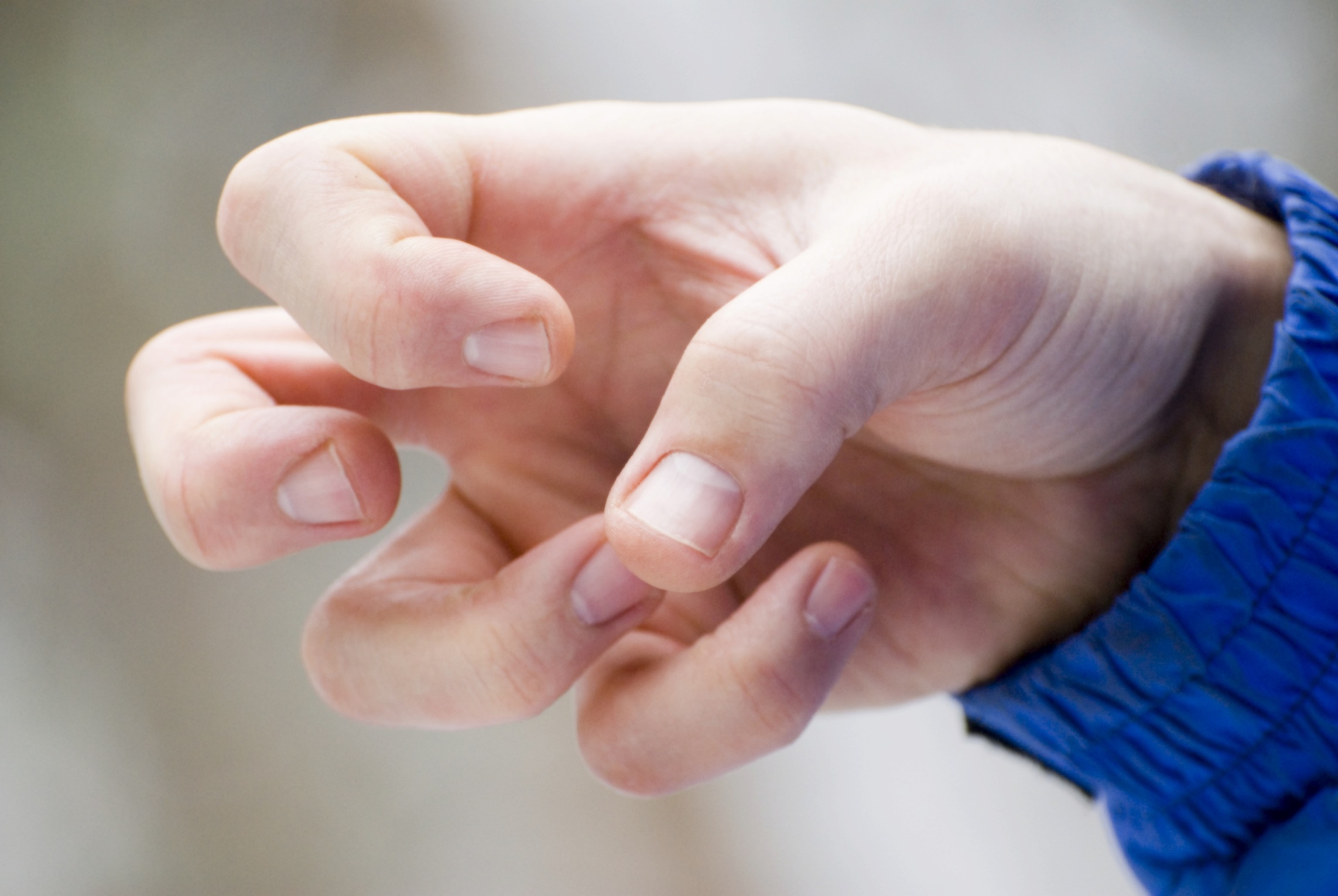 Study Suggests a Possible Link Between Epilepsy and ADHD Study Suggests a Possible Link Between Epilepsy and ADHD